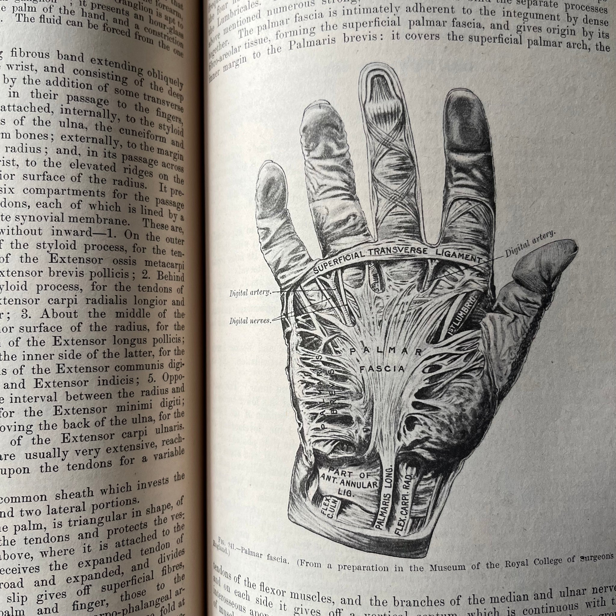 The Classic Collector's Edition Gray's Anatomy - 1977 Edition - Log ...